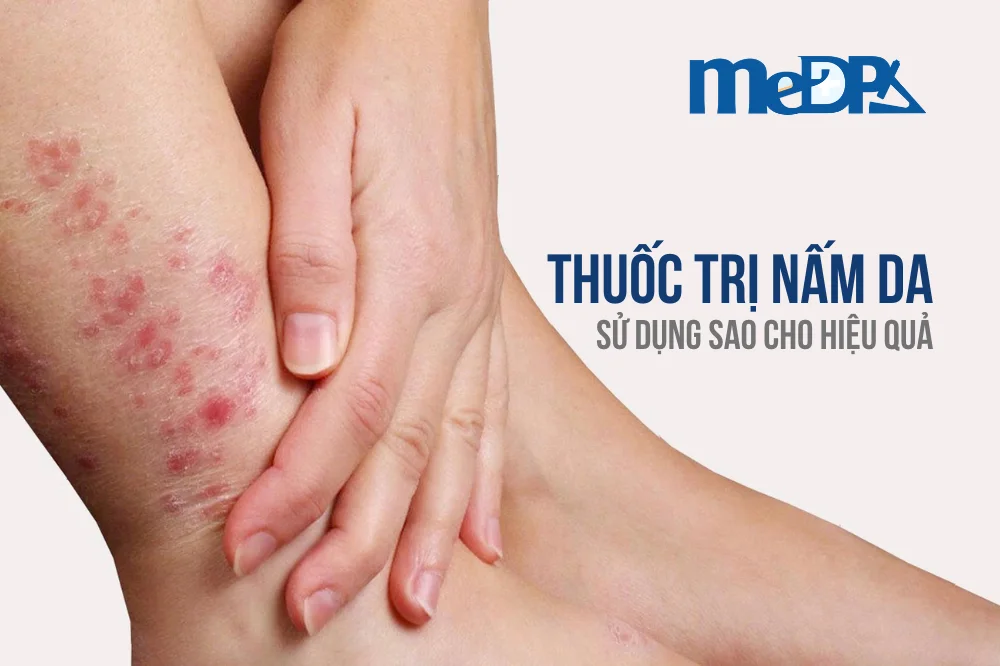 Thuốc trị nấm da và cách sử dụng hiệu quả khi điều trị